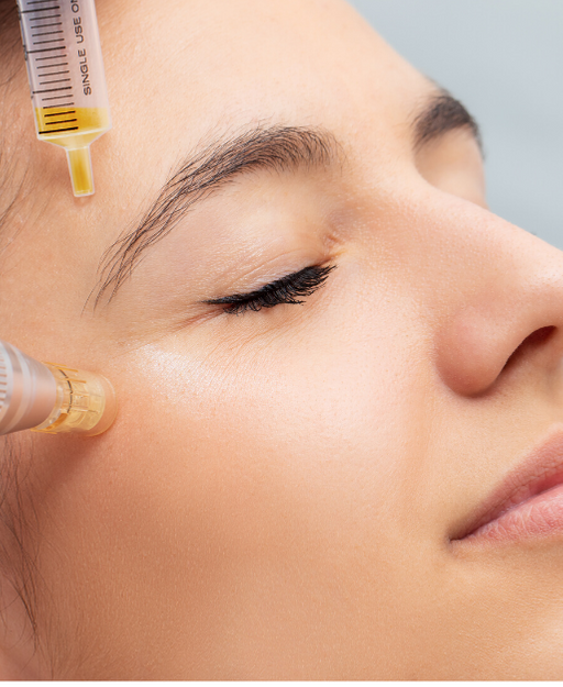 Microneedling Melbourne | Collagen Induction Therapy – Bella Skin ...